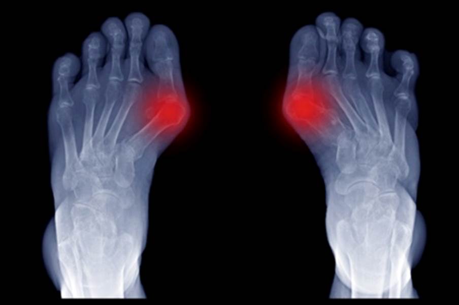 Conditions Treated - Pro Health Podiatry